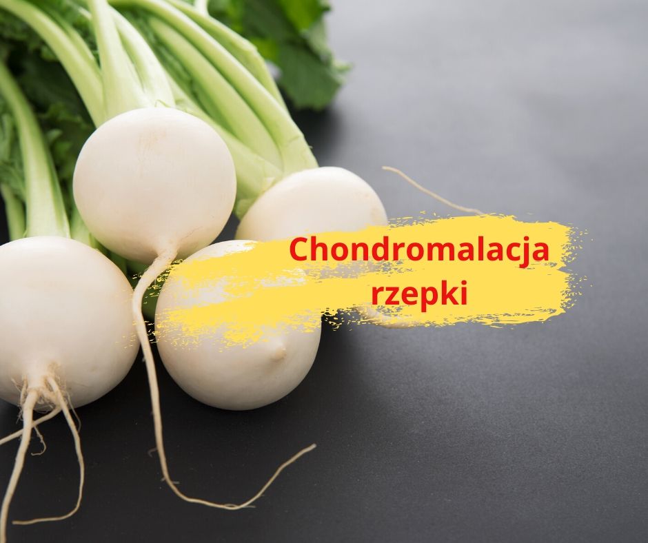 Chondromalacja rzepki - objawy, leczenie i rehabilitacja - Fizjo Gabinet